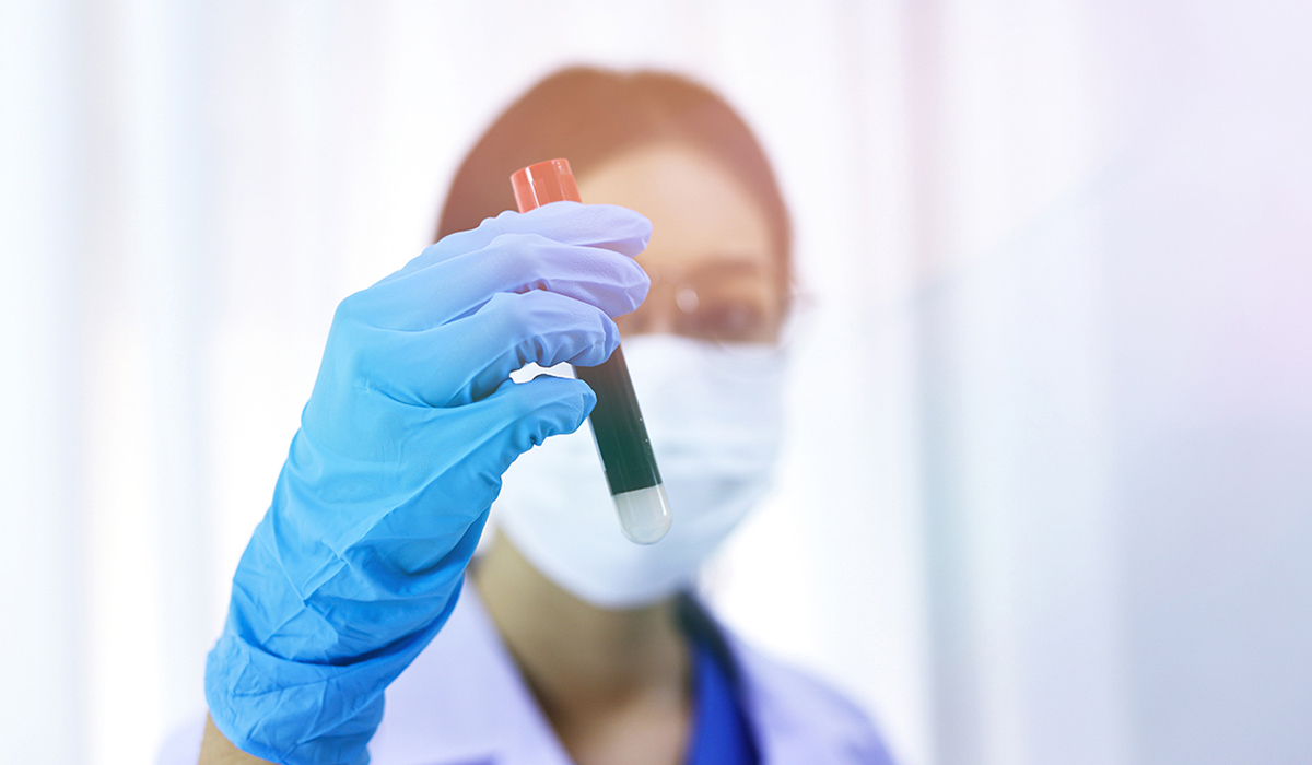 Sample Collection for Clinical Flow Cytometry | KCAS Bio
