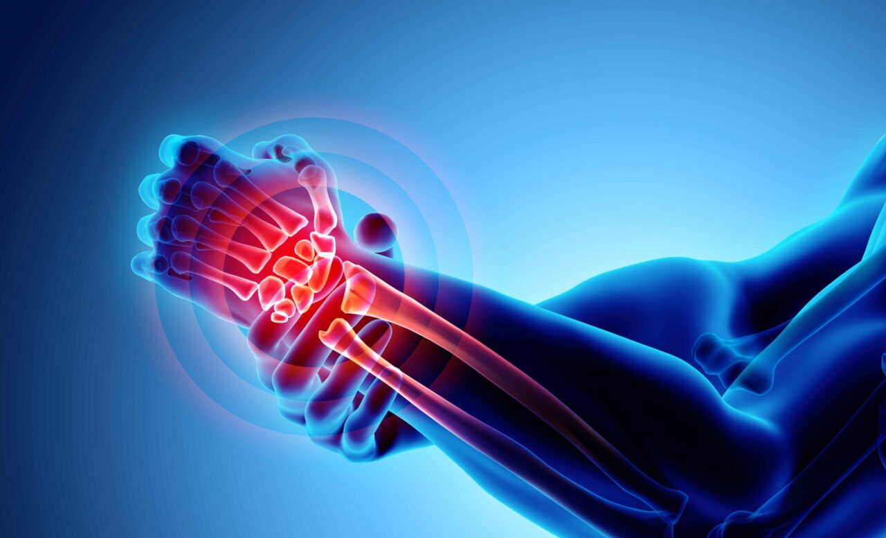 Inflammation & Pain CRO Services - KCAS Bio