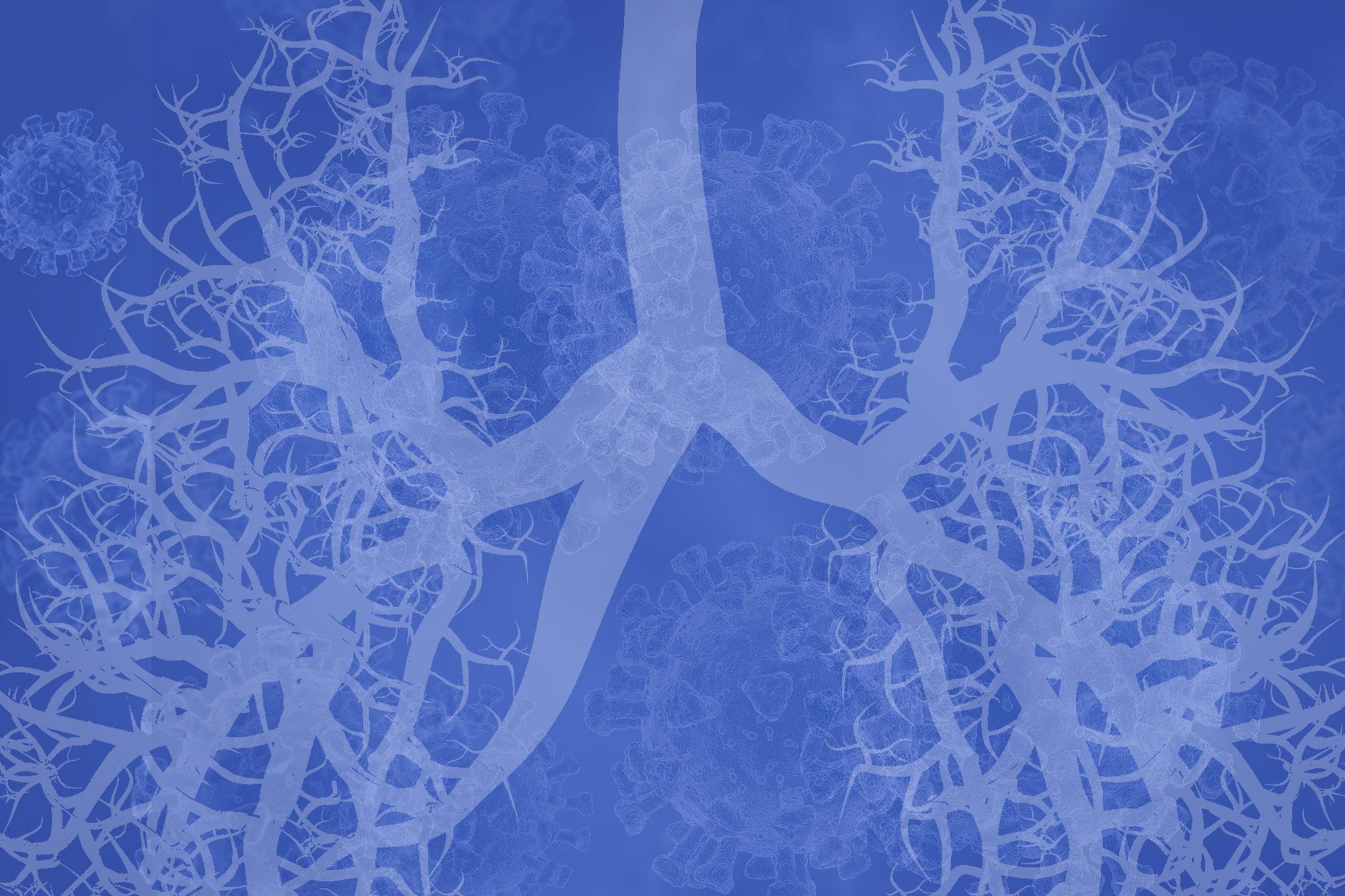 Respiratory CRO in Immune Monitoring | KCAS Bio